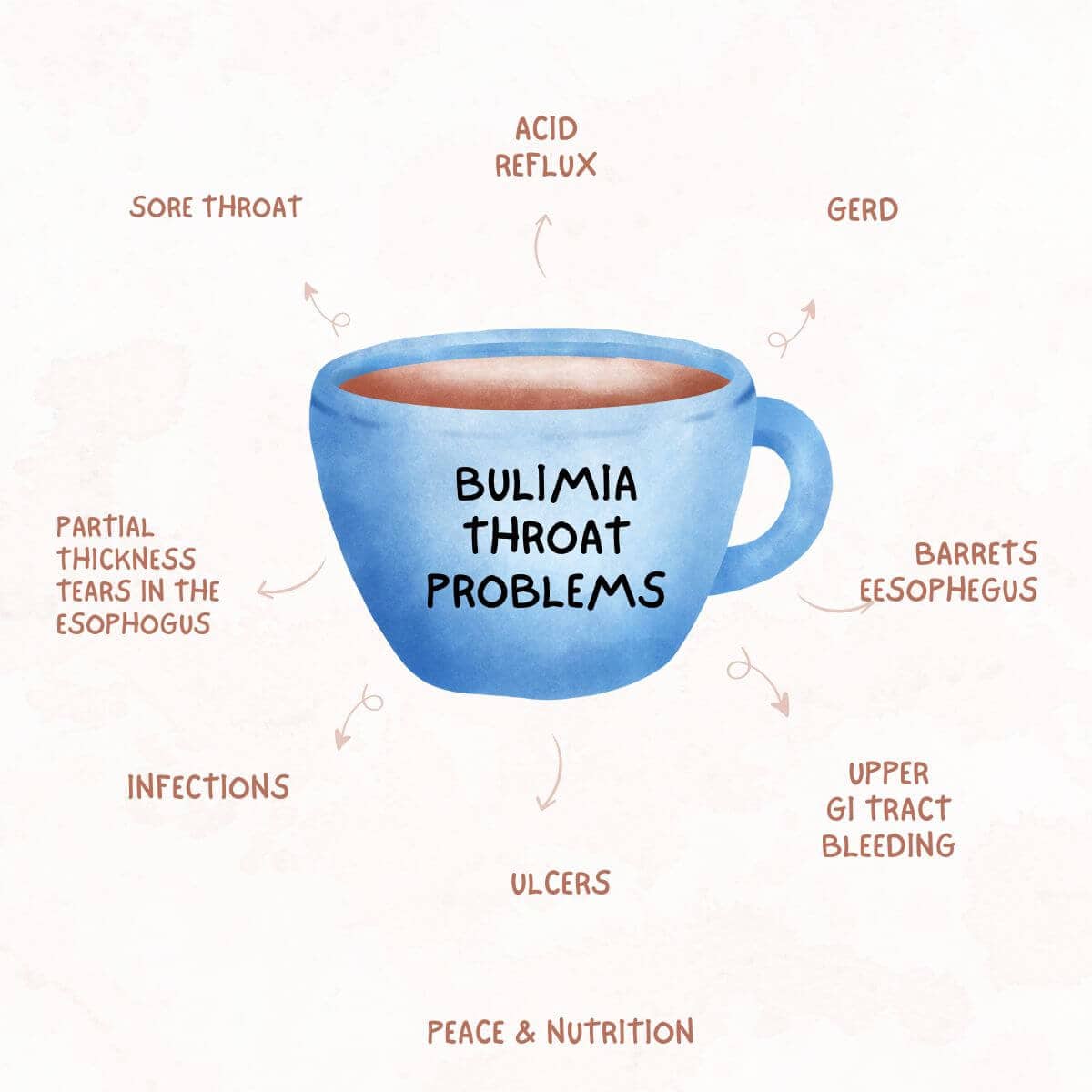 "Bulimia Face" and Teeth: Signs and Symptoms Explained | Peace & Nutrition™